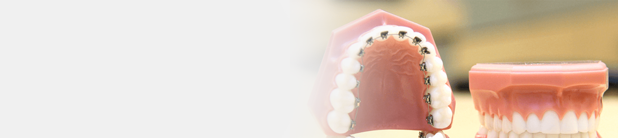 Internal Lingual Braces Melbourne - Core Dental